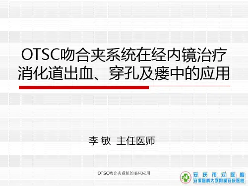 OTSC吻合夹在内镜下治疗消化道穿孔和瘘中的应用 - 文档之家